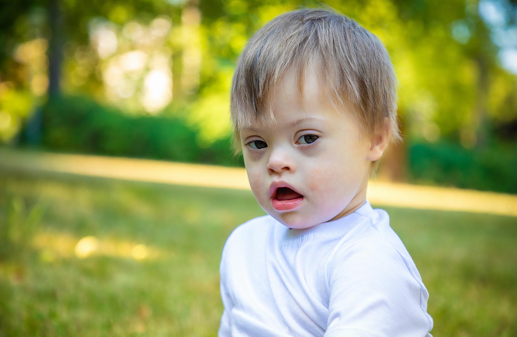 Down Syndrome Everything You Need To Know OrbRom Center Down Syndrome Everything You Need To Know OrbRom Center